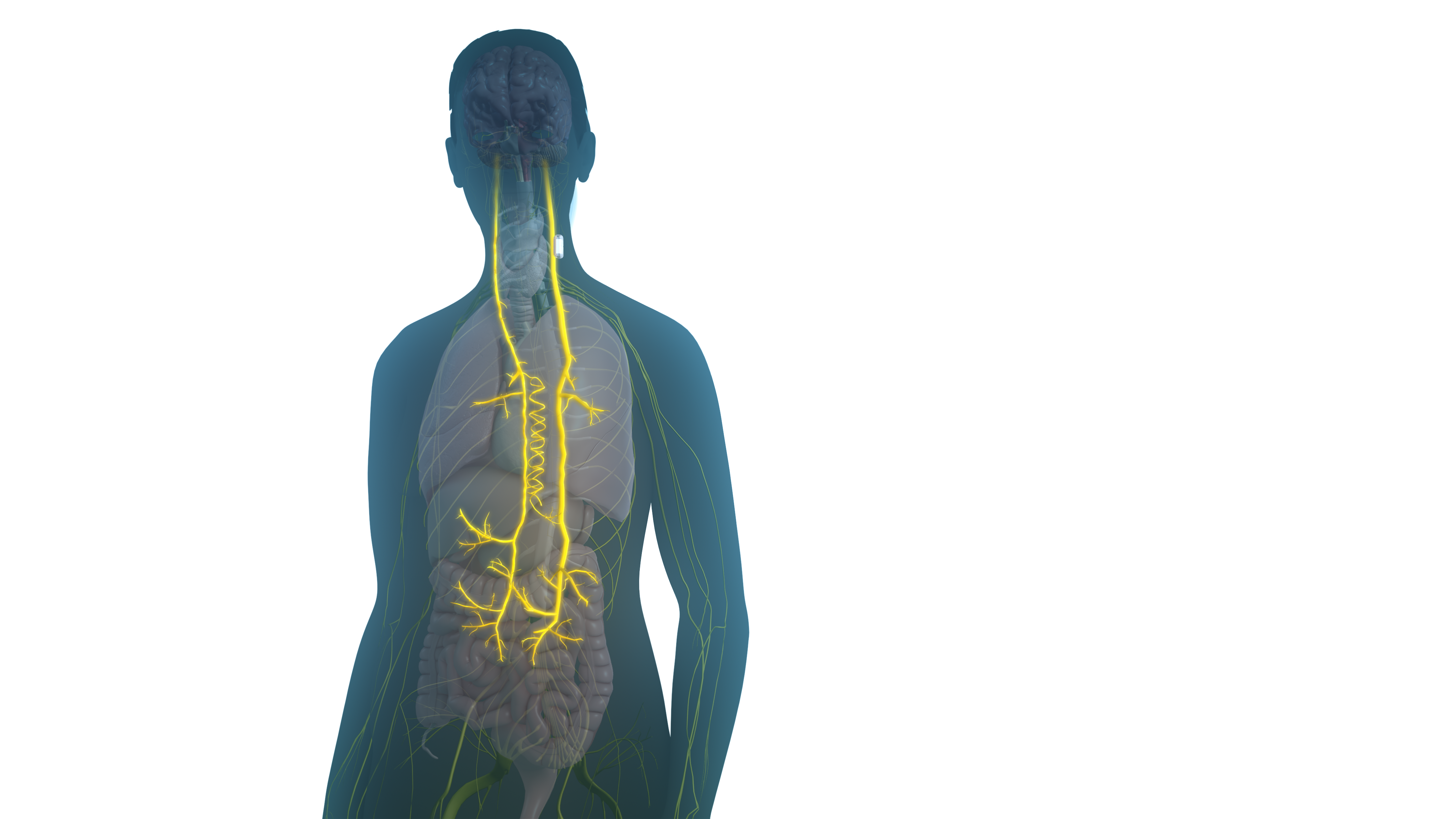 SetPoint's Miniature Implant Offers New Hope for Rheumatoid Arthritis ...